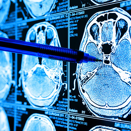 Artificial intelligence for cancer detection and treatment planning ...